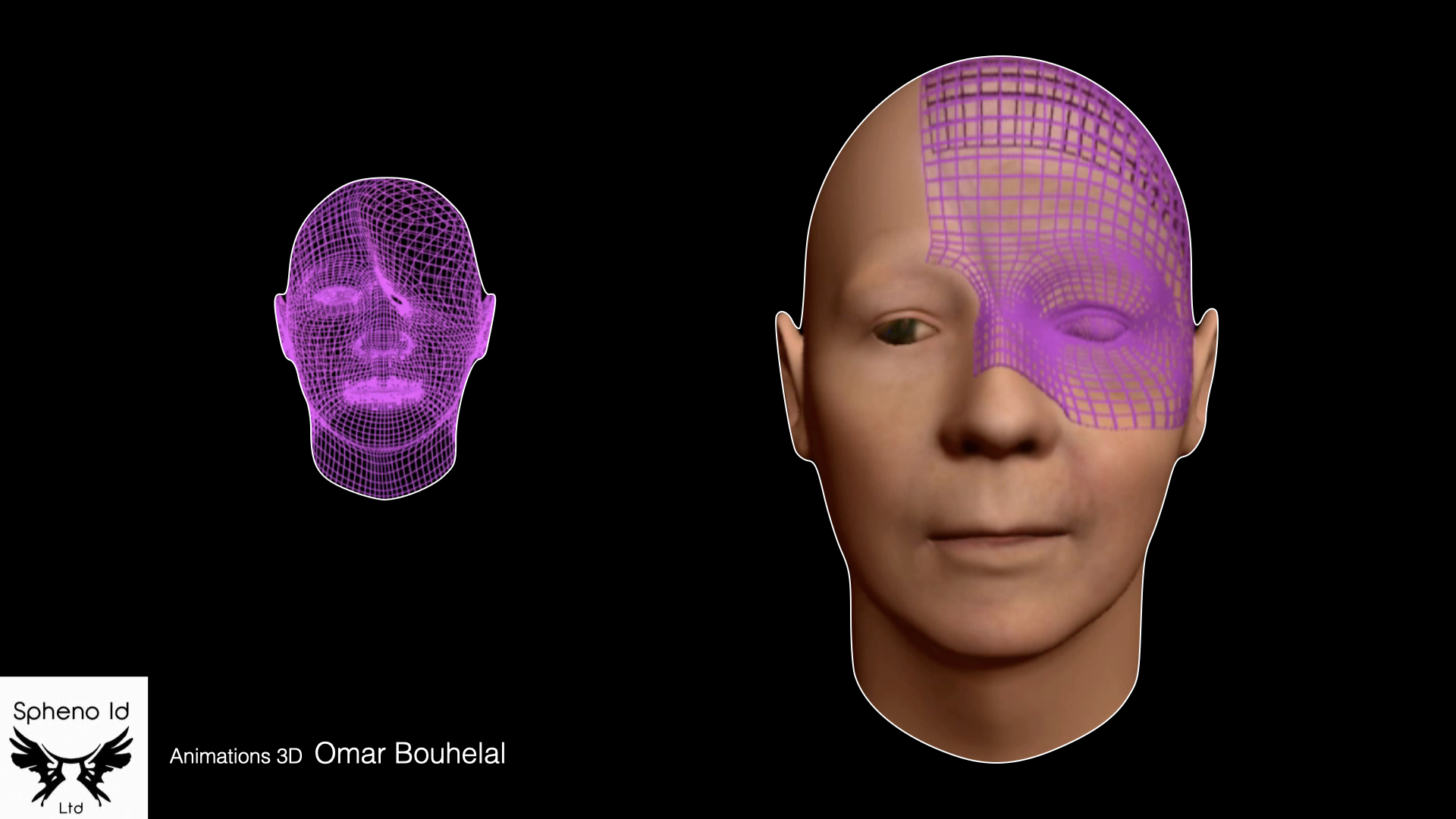 Qu'est ce que l'épithèse ou Prothèse faciale